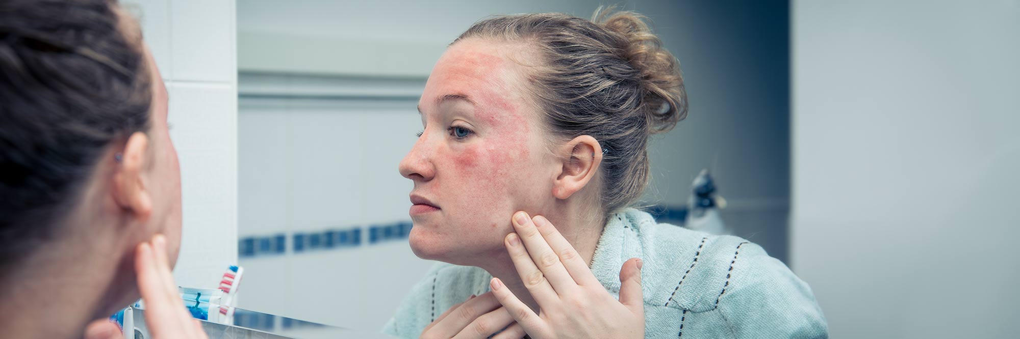 What staph infections look like and how they happen | HealthPartners Blog